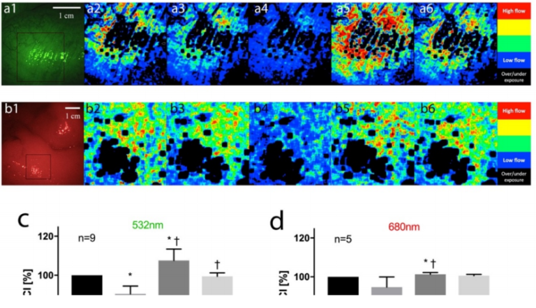 Application of laser speckle contrast imaging in laparoscopic surgery